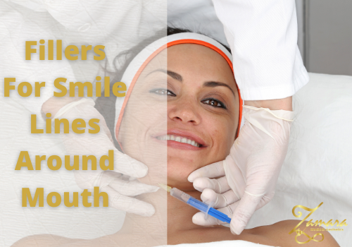 Fillers For Smile Lines Around Mouth - Zamara Med Spa